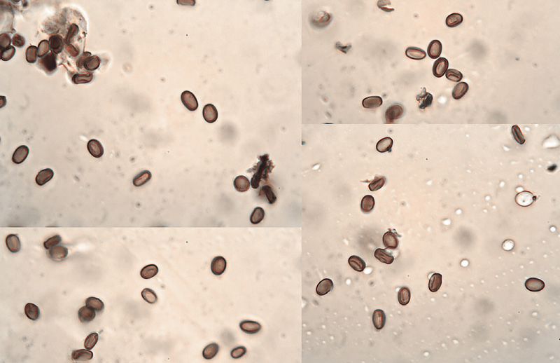 Cryptostroma corticale