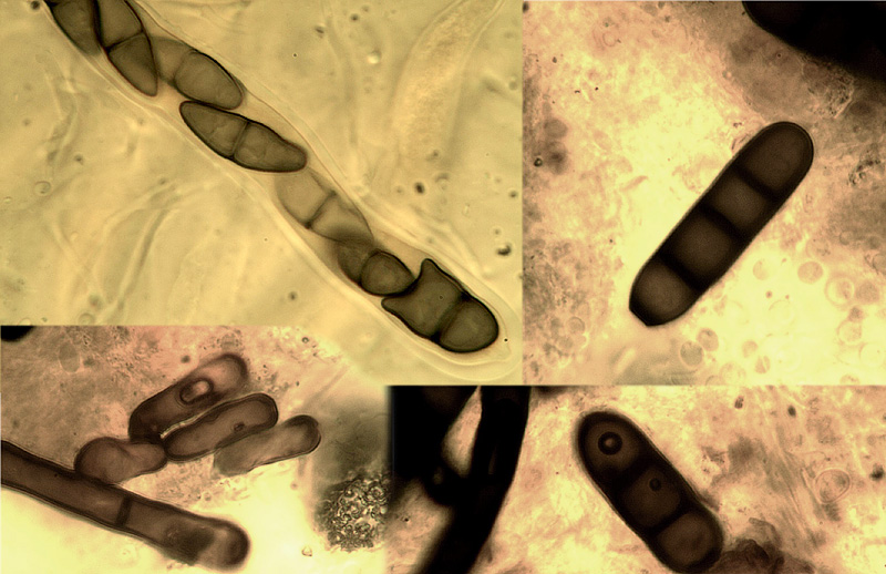 Kirschsteiniothelia aethiops
